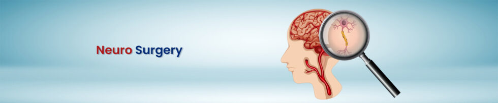 The Best Neurosurgery Hospitals in Hyderabad