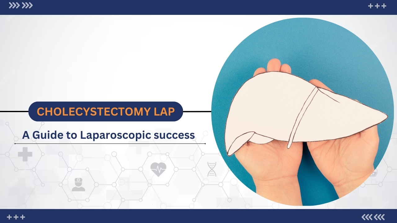 Laparoscopic Cholecystectomy for Optimal Recovery - Wellness Hospitals
